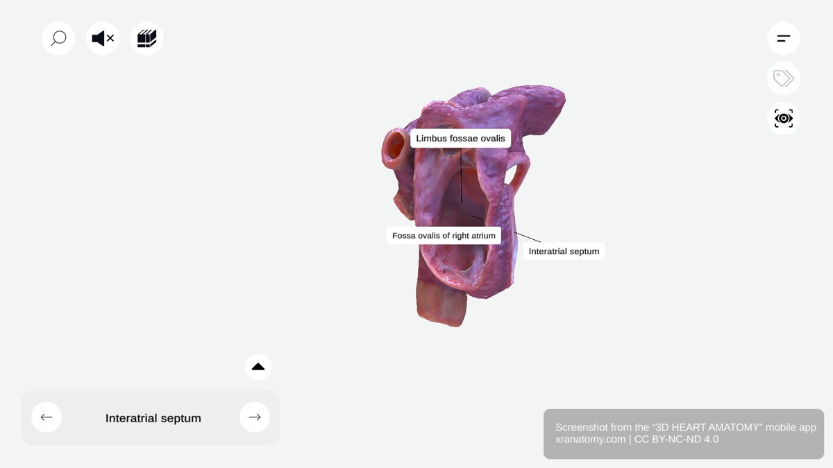Cardiac Septum - 3D Heart Anatomy