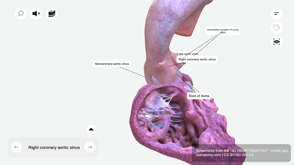 Root of Aorta - 3D Heart Anatomy
