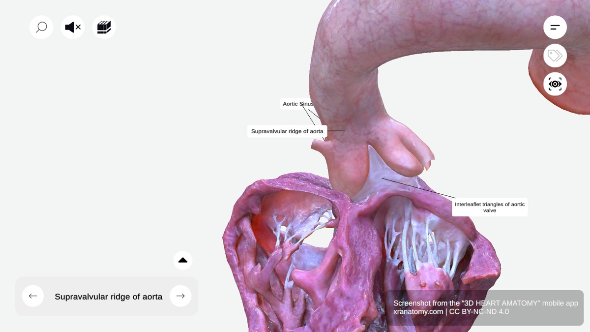 Root of Aorta - 3D Heart Anatomy