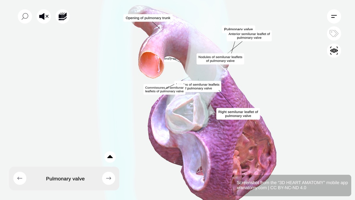 Root of Pulmonary Trunk - 3D Heart Anatomy
