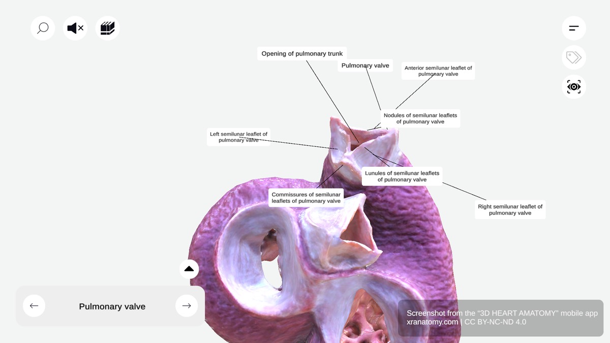 Root of Pulmonary Trunk - 3D Heart Anatomy